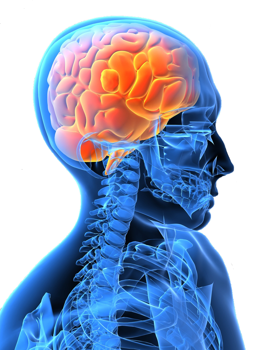 Stroke Treatment And Management Of Its Effects With Ayurveda Best 